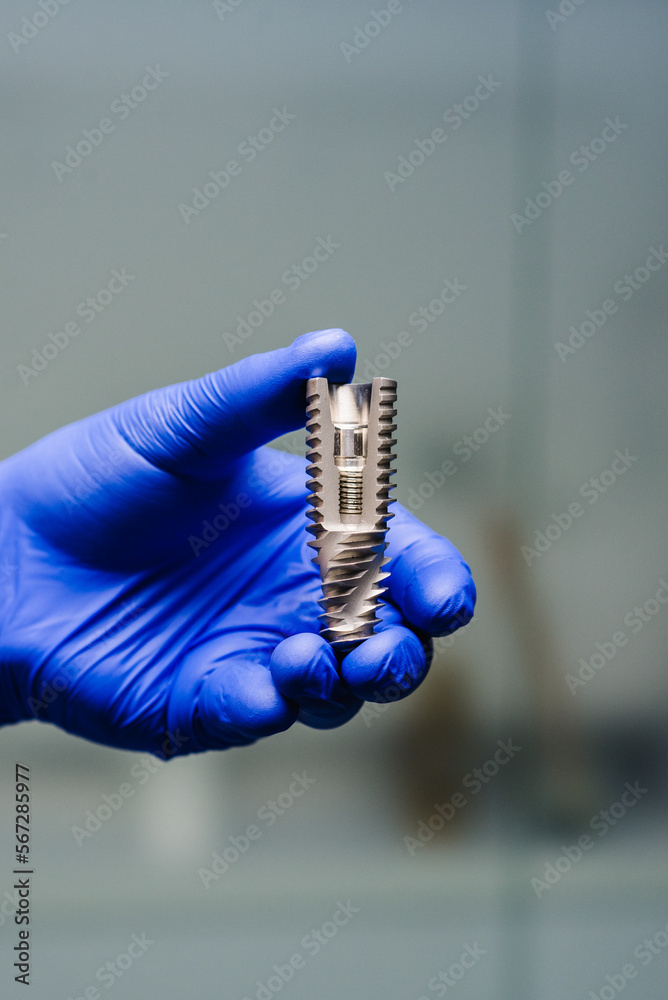 Dental implant. Dentist hold a model of dental implant in hand. Concept ...