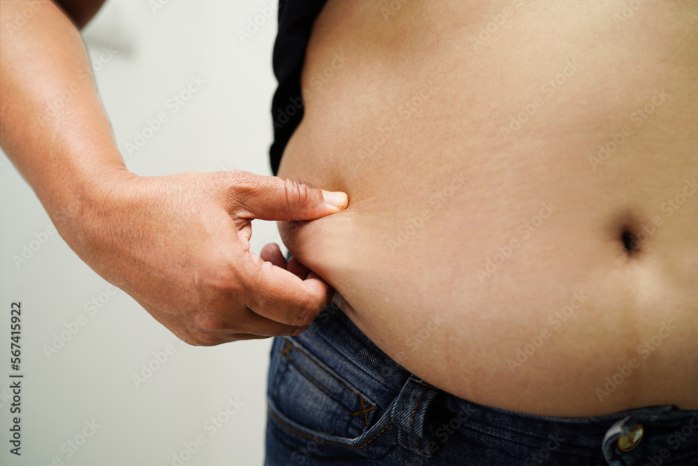 Overweight asian woman use hand to squeeze fat belly big size ...