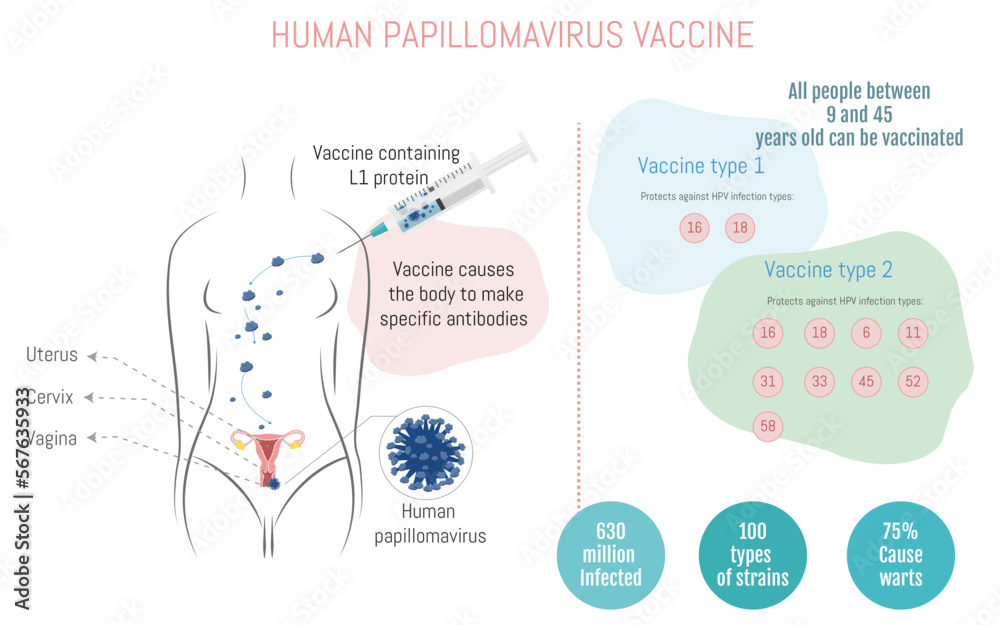 Infographic on how human papillomavirus vaccines work, and types of ...