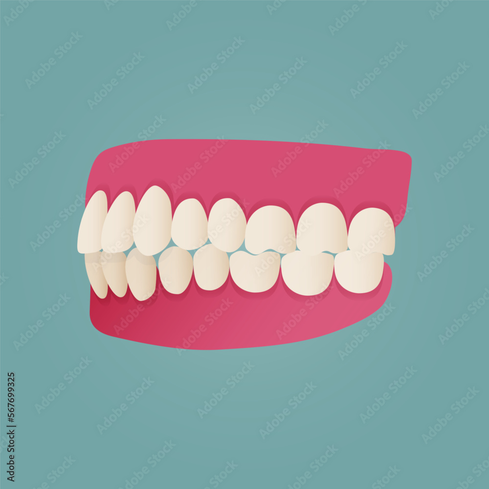 Medical dental diagram illustration. Orthodontist human tooth anatomy ...