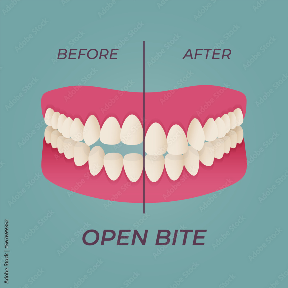 Medical dental diagram illustration. Orthodontist human tooth anatomy ...