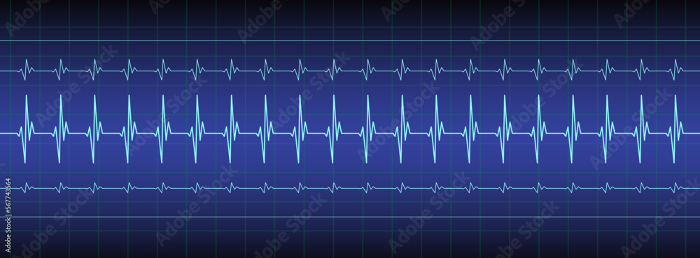 ecg, ekg monitor with cardio diagnosis illustration. Heart rhythm line ...