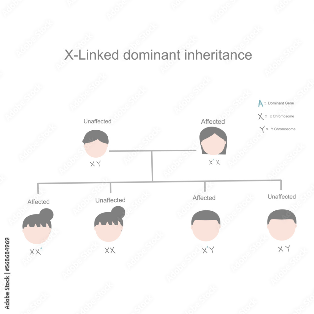 The inheritance pattern diagram of X- linked dominant that showing of ...