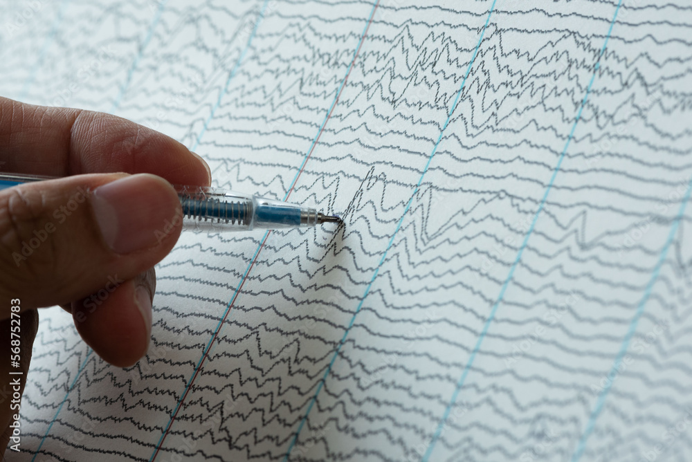 Poster Doctor pointing at EEG of abnormal brain waves – Wall Art ...