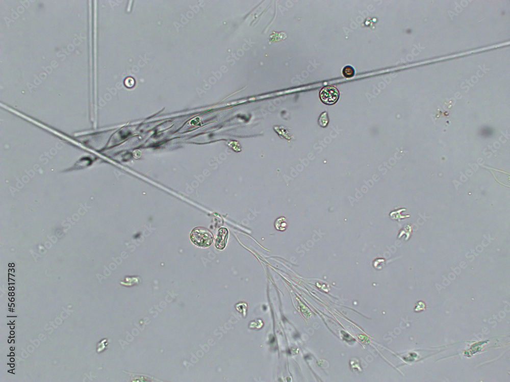 Diatoms, algae under microscopic view, phytoplankton, fossils, silica ...