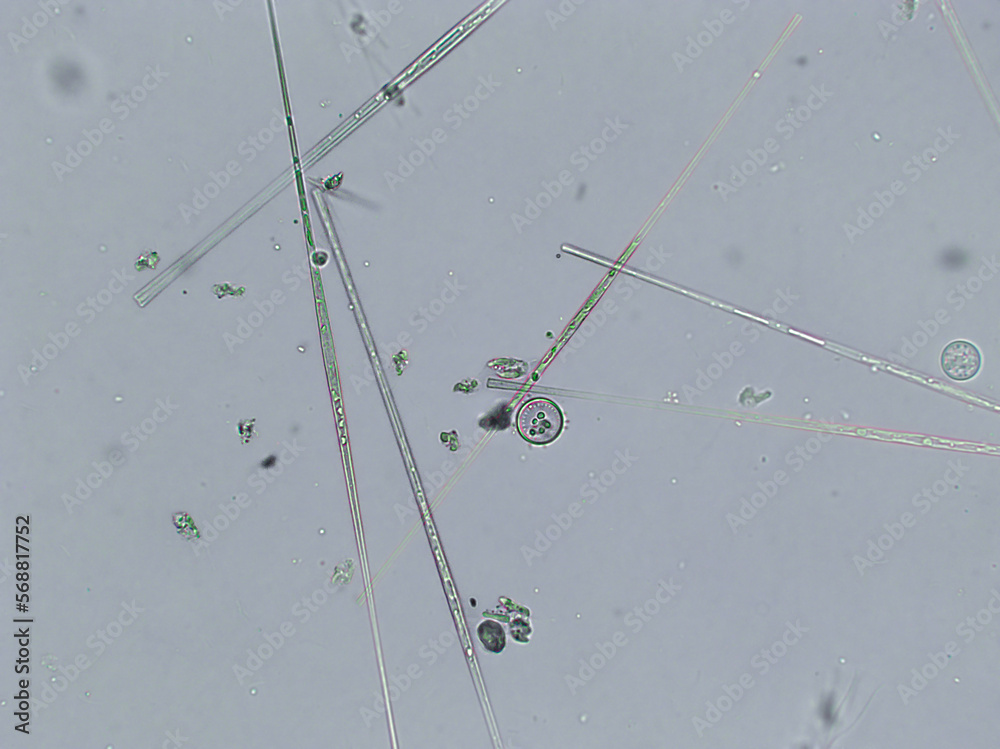 Diatoms, algae under microscopic view, phytoplankton, fossils, silica ...