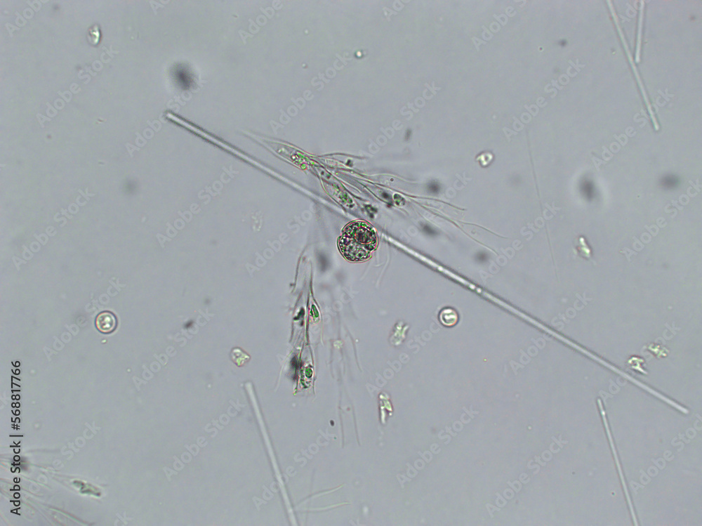 Diatoms, algae under microscopic view, phytoplankton, fossils, silica ...