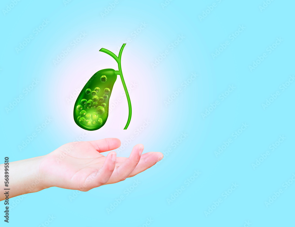 Gallbladder with stone. Care and treatment of gallstones, cholecystitis ...