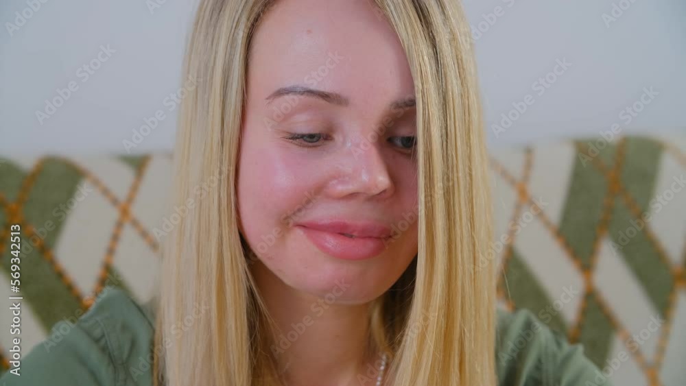 Injured young Ukrainian woman with prosthetic eye and scarred face ...