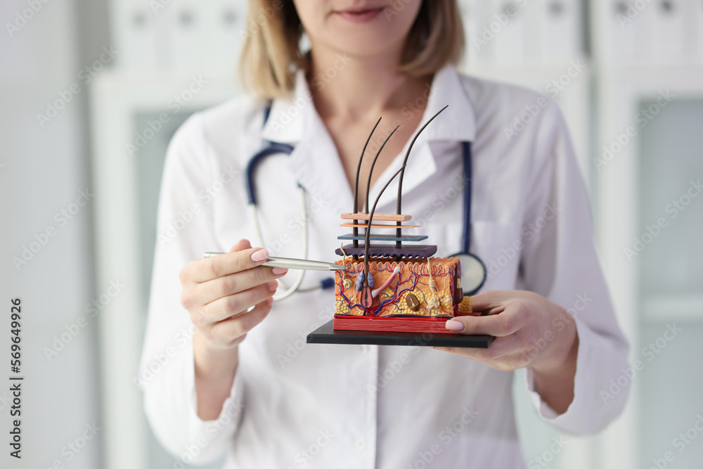 Female dermatologist holds artificial model of human skin with hair ...