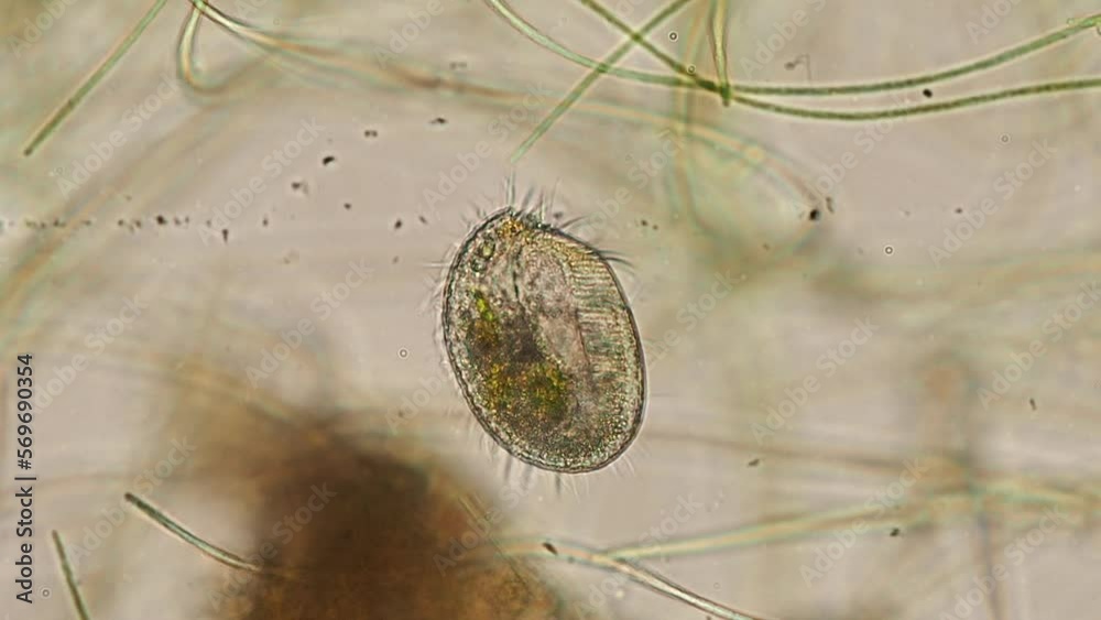 marine ciliate (single celled organism) under the microscope - light ...