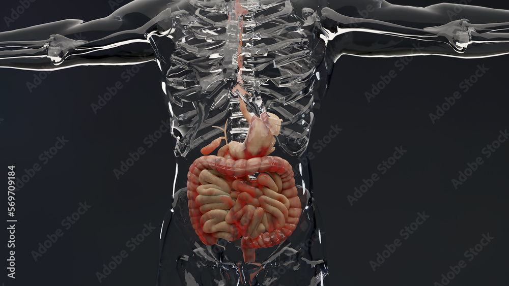 Poster man suffering from crohns disease, male anatomy, inflamed large ...