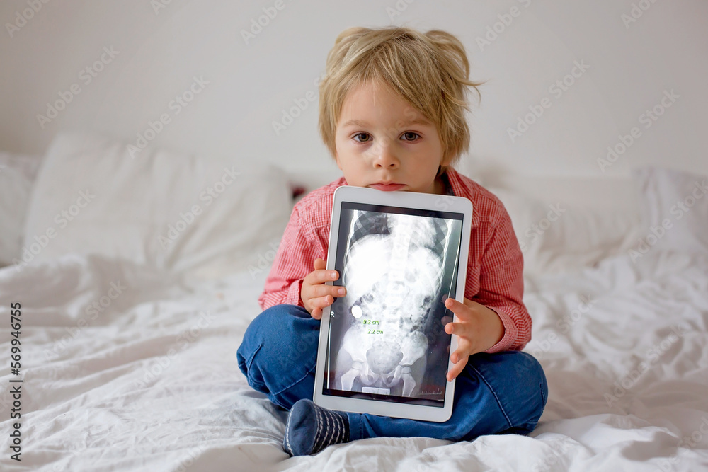 Toddler child, holding x-ray picture on tablet of child body with ...