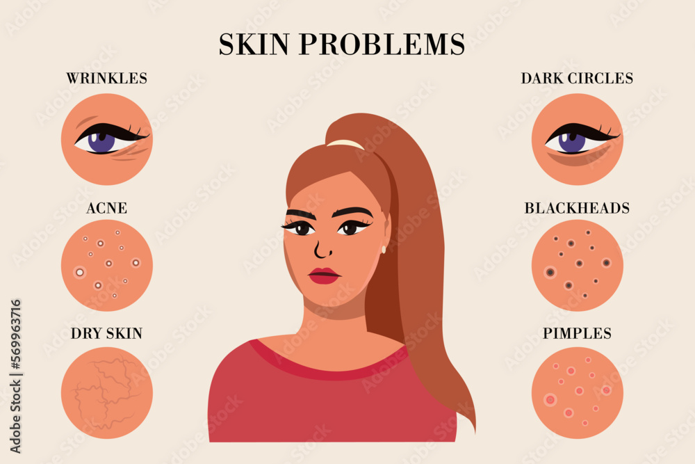 sad woman and set of most common female facial skin problems needs to ...