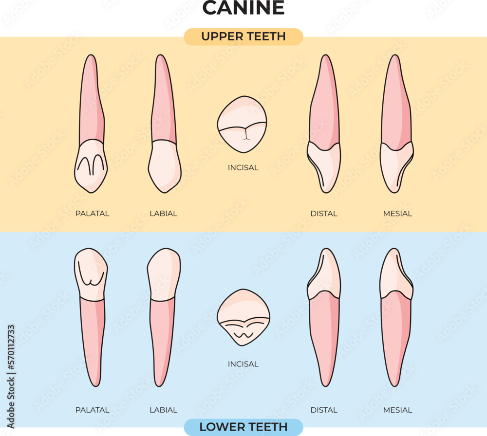 anatomy of the upper and lower canines in various positions that can be ...