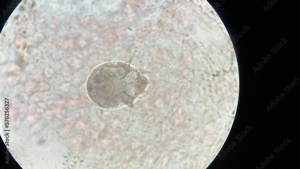 Notoedres cati under the microscope. Notoedric mange, also referred to ...