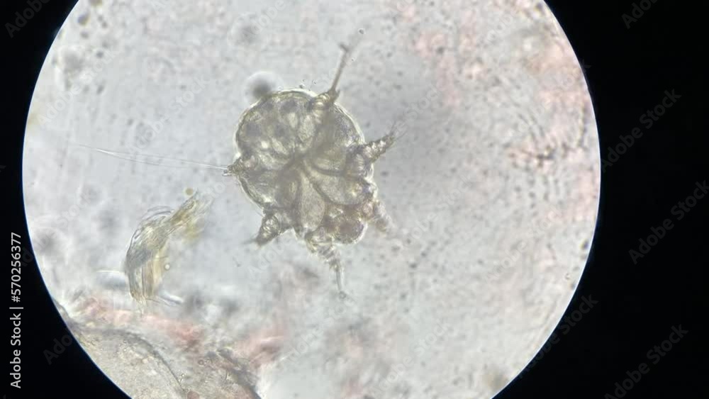 Notoedres cati under the microscope. Notoedric mange, also referred to ...