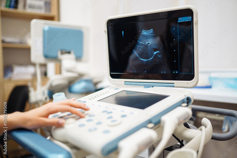 Ultrasound machine in the doctor's office in the clinic Diagnostics ...