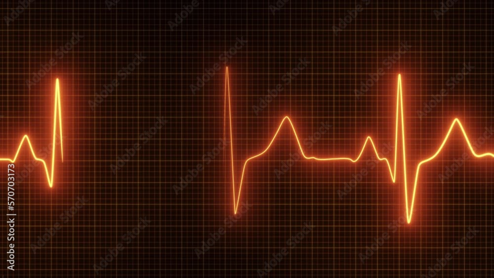 Dynamic heart rate or heart beat line. Cardiogram signal. Red colors ...