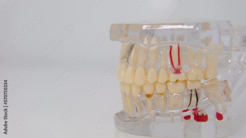 Mock-up Jaws on white background reflection teeth skeleton plastic ...