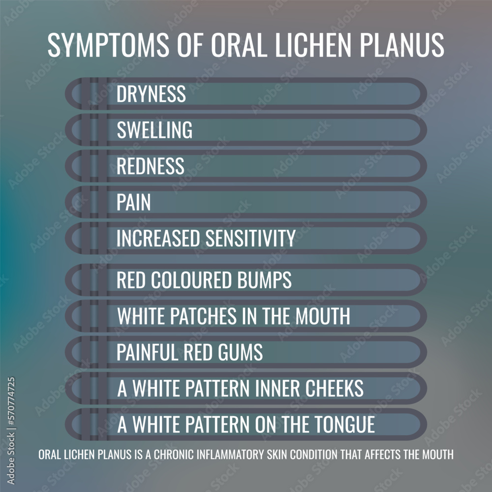symptoms of Oral lichen planus. Vector illustration for medical journal ...