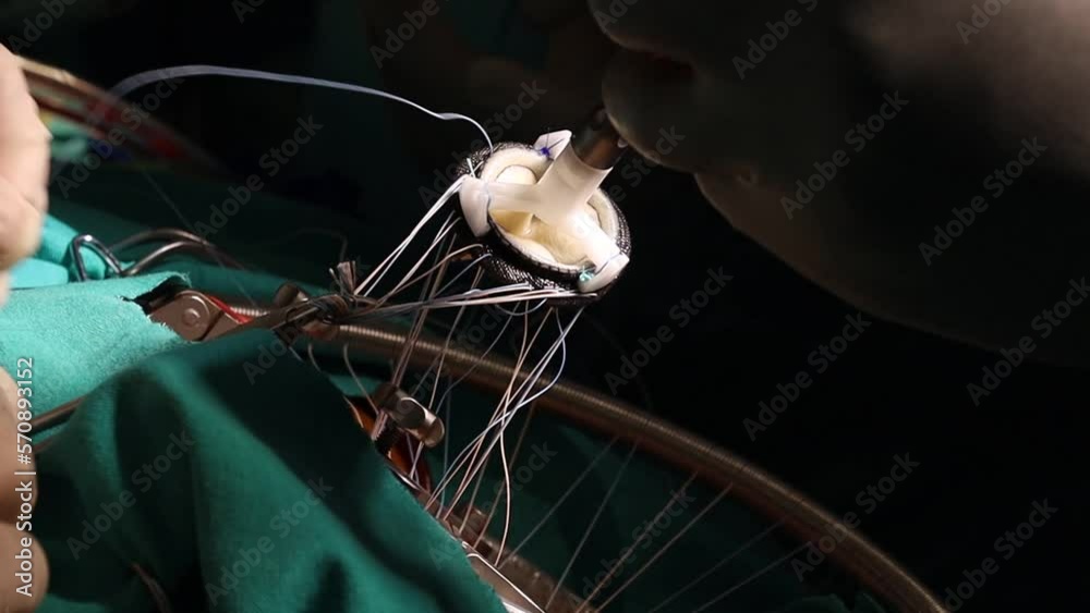 Suturing artificial heart valve. Close-up doctor hands and heart valve ...