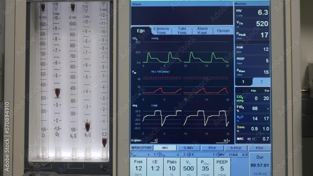 4K Monitor of anesthesia machine ventilator. Medical equipment for ...