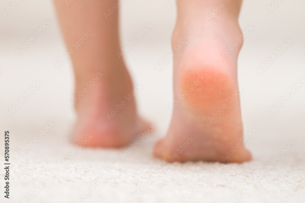Little child feet on light soft carpet background. Barefoot step ...