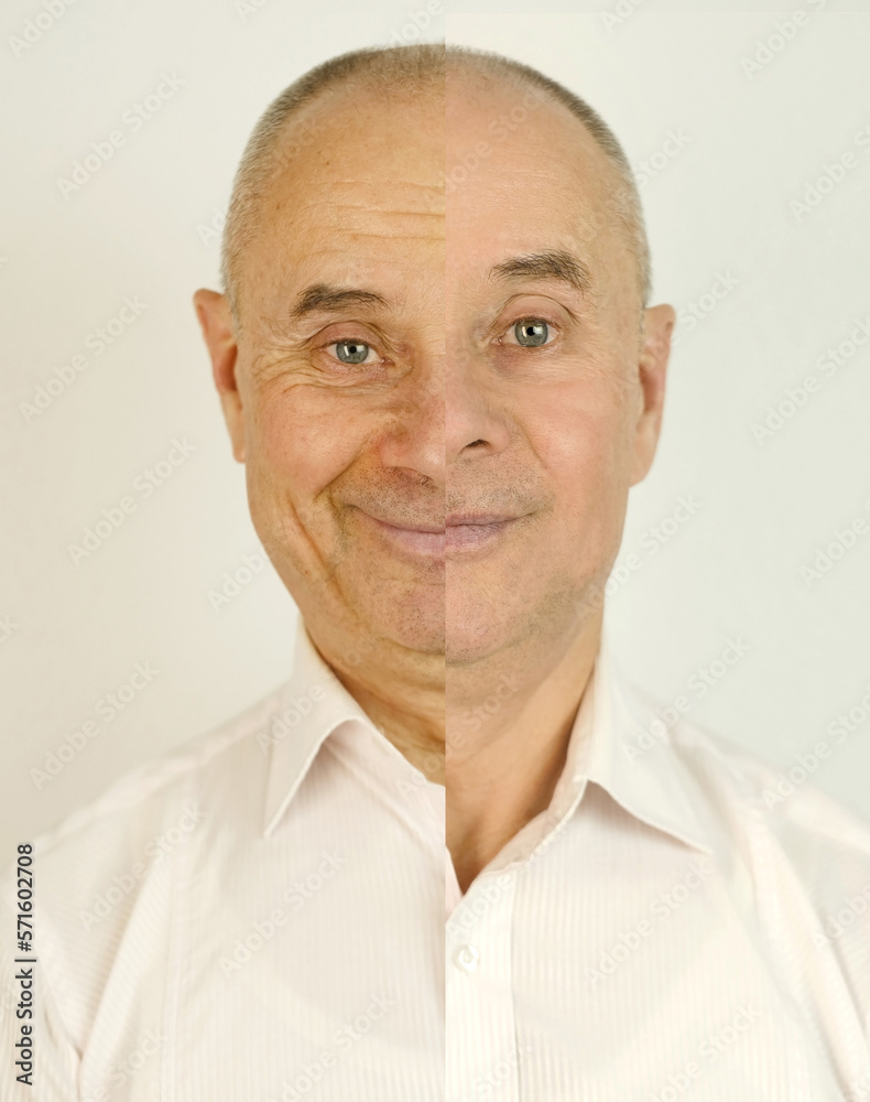 elderly caucasian male face with puffiness under eyes and wrinkles ...