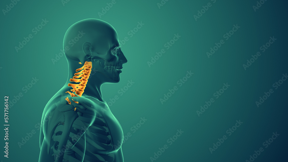Cervical posture syndrome or neck pain medical background Stock ...
