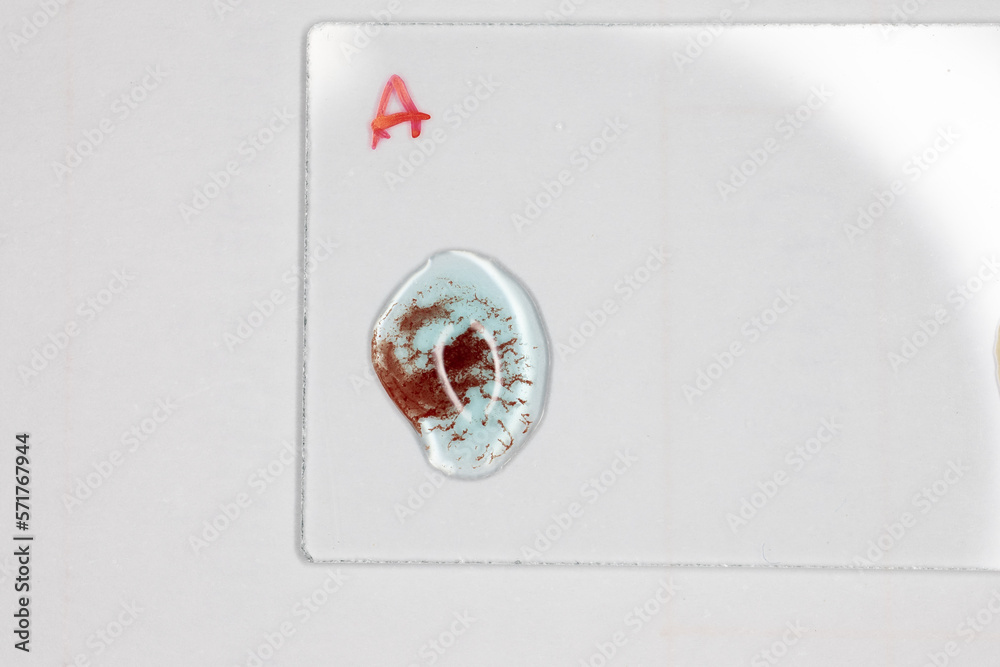 Human blood cells, Blood group and white blood cell study under ...