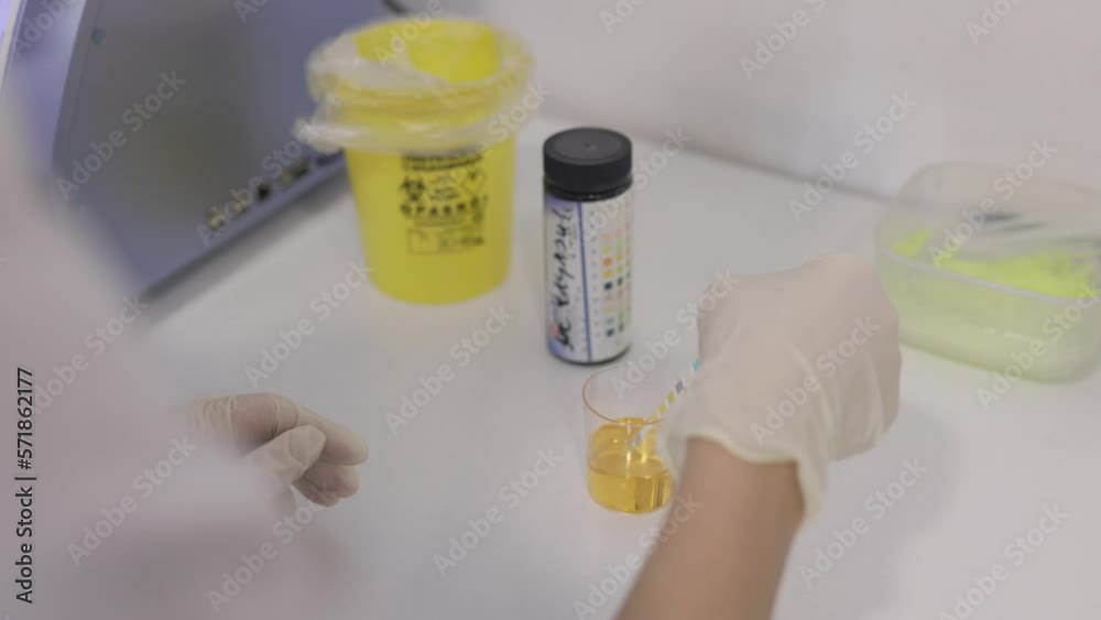 Reagent Strip for Urinalysis , Routine Urinalysis, check-up analysis in ...