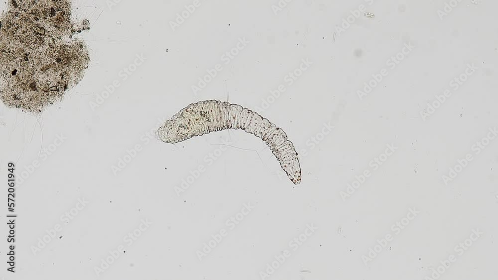 Aeolosoma (minute annelid worm) under the microscope - light microscope ...