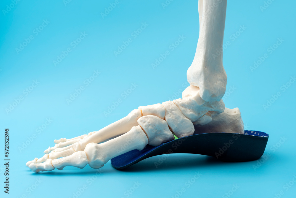 Anatomical model of the bones of the human foot wearing an orthopedic ...