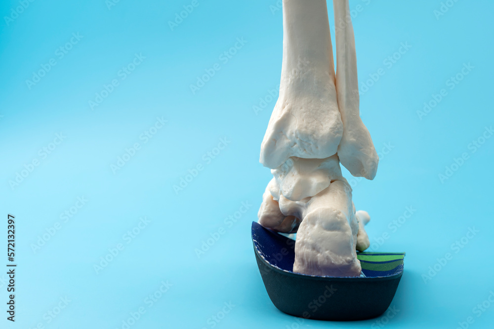 Póster Anatomical model of the bones of the foot wearing an orthopedic ...