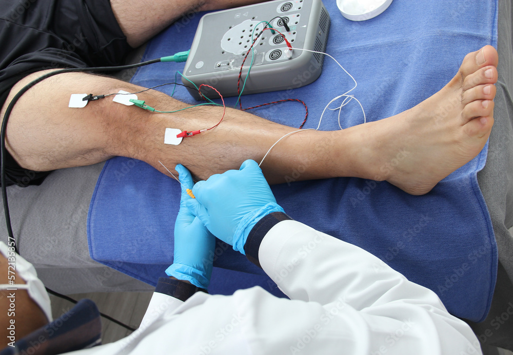 Fotka „Electromyography in the lower limbs, graphic recording technique ...