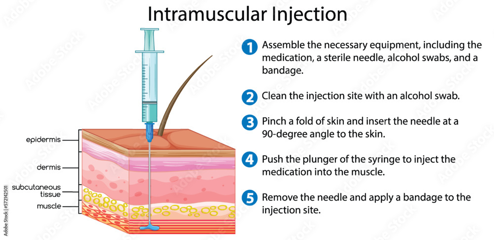 Intramuscular Injection with explanation Stock Vector | Adobe Stock