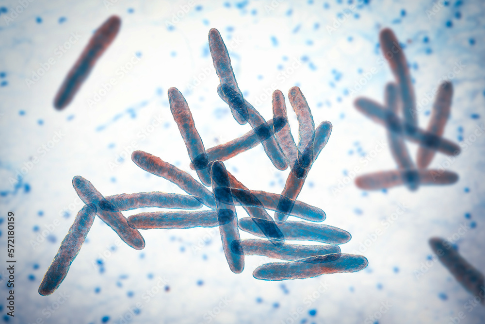 Mycobacterium ulcerans, the causative agent of Buruli ulcer, 3D ...