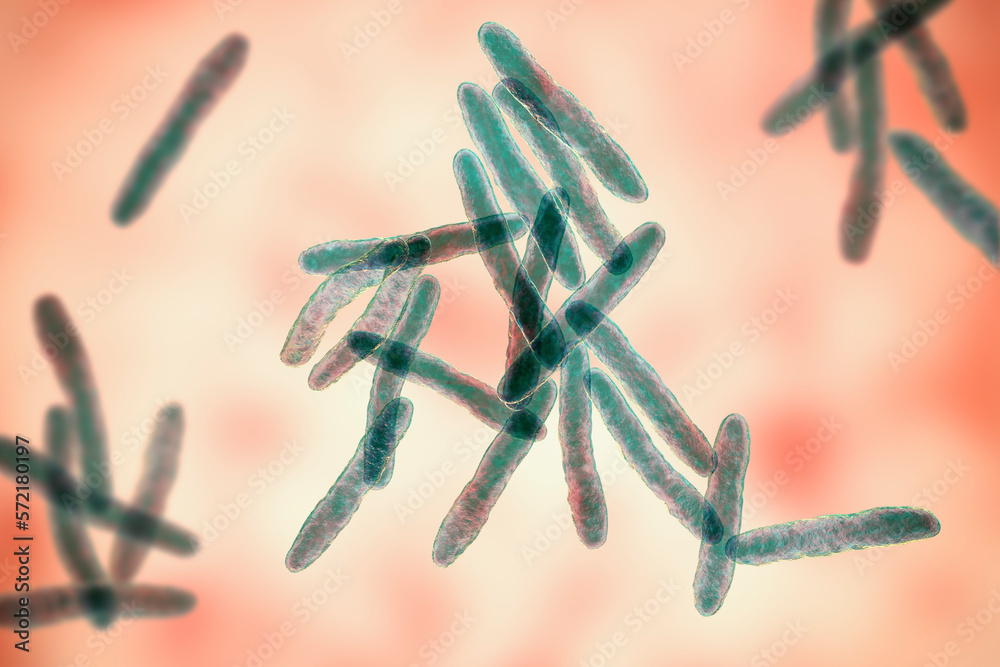 Mycobacterium ulcerans, the causative agent of Buruli ulcer, 3D ...