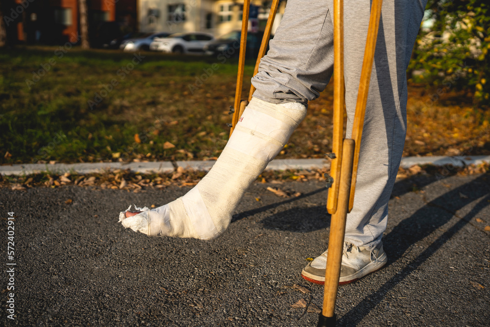A young man with a broken leg, walking on crutches. Stock Photo | Adobe ...