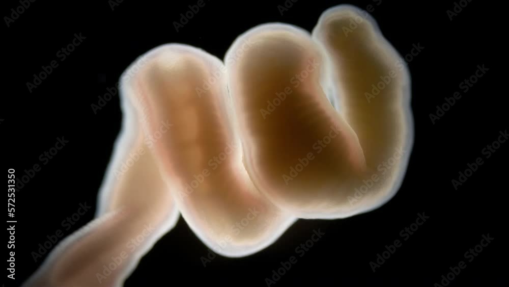 Nemertea worm Cephalothrix linearis under a microscope, class ...