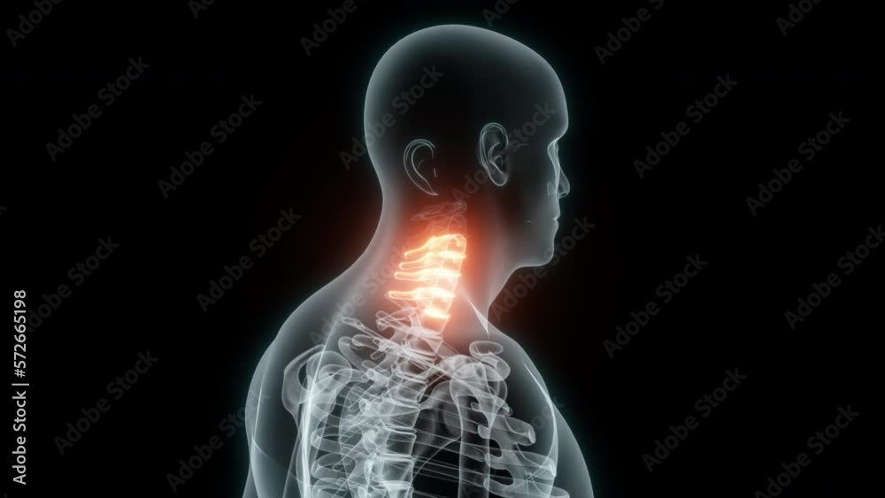 3D Rendering of a Medical Animation of the Cervical Vertebrae. X-ray of ...
