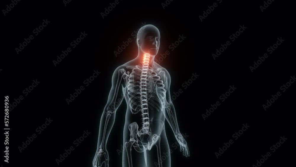 3D Rendering of a Medical Animation of the Cervical Vertebrae. X-ray of ...
