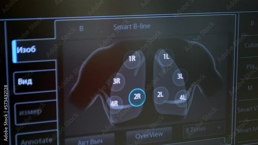 Utrasound image on the monitor close-up. Ultrasound Scan display ...