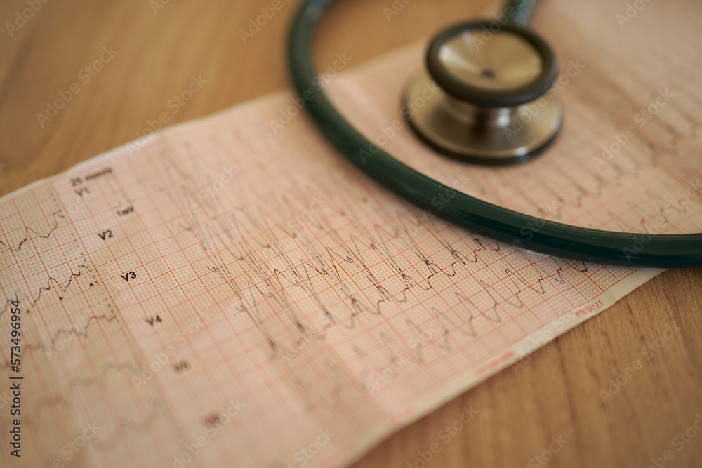 stethoscope on a real emergency ECG with a rhythmic tachycardia (180 ...