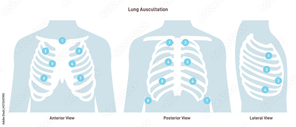 Lung auscultation. Thorax anterior, posterior, lateral position Stock ...