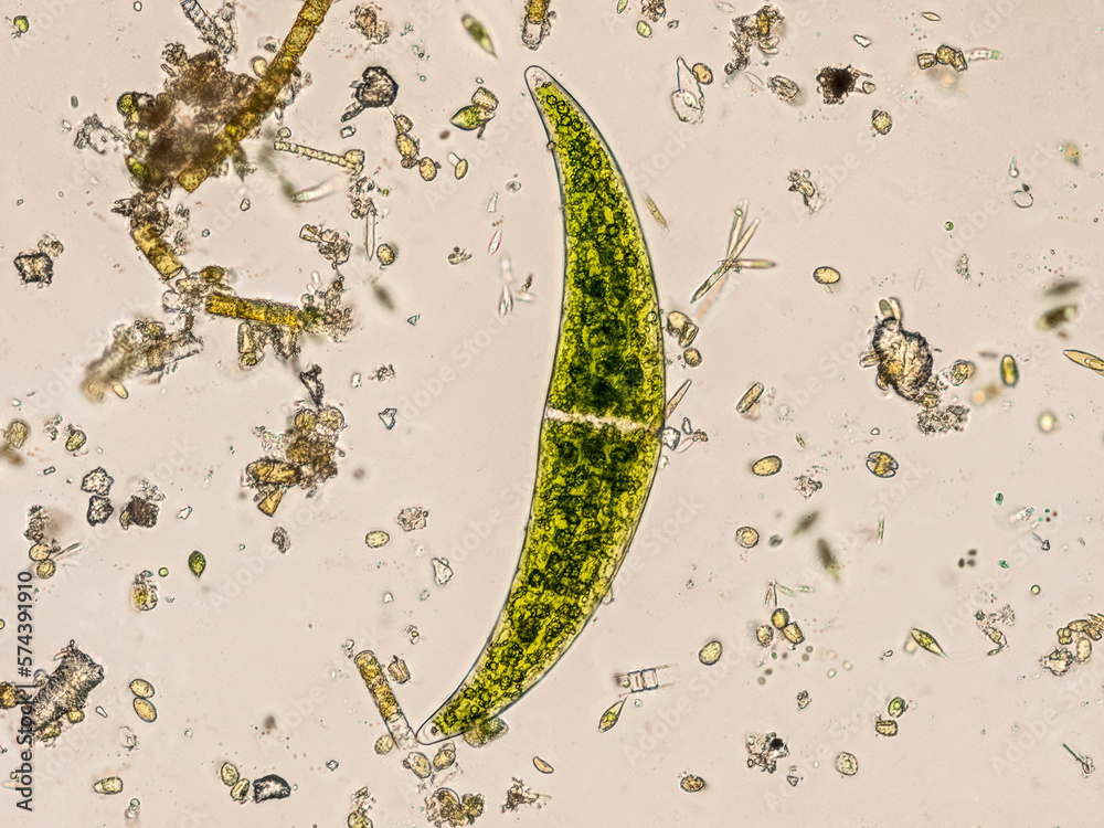 Stockfoto Freshwater Closterium algae (unicellular charophyte green ...
