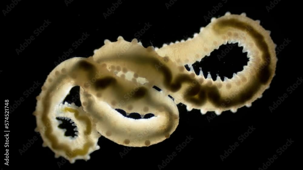 Worm family Sphaerodoridae under a microscope, possibly Sphaerodorum ...