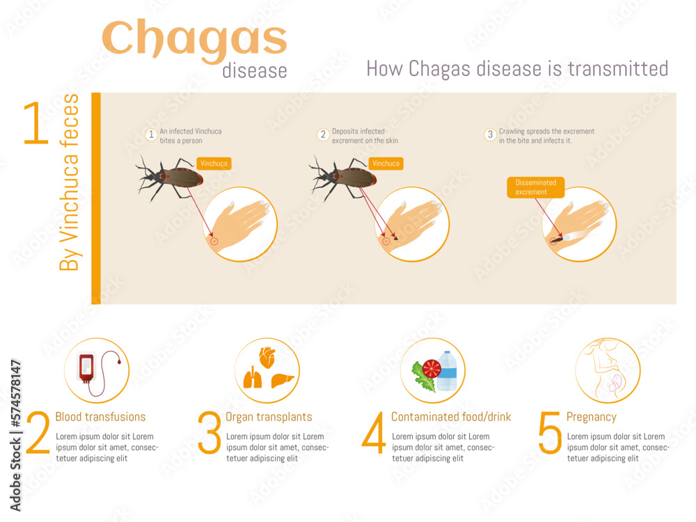 Infographic on how chagas disease is transmitted: bites, blood ...