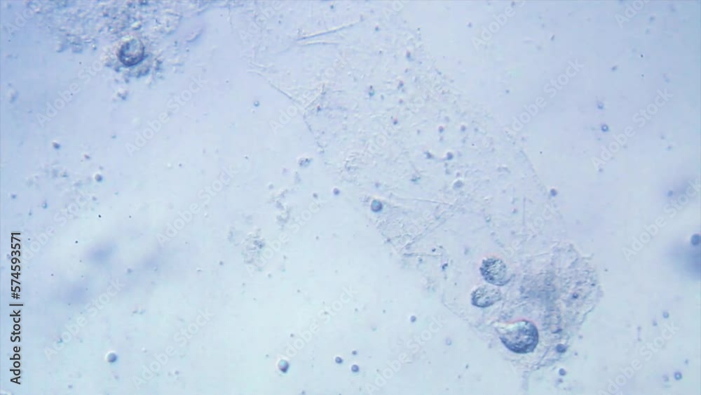 disease sickness disease death fleas black plague death microscopic ...
